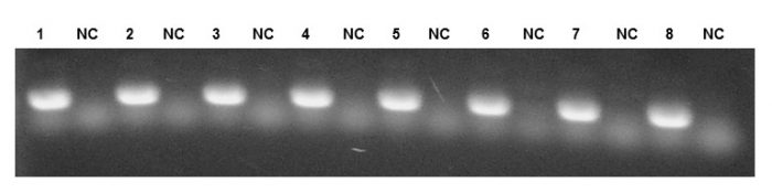 Tissue cDNA Products – Zyagen